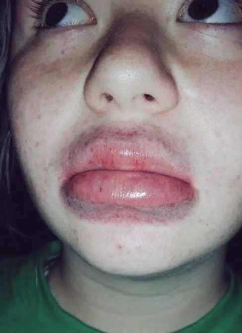 “Glued Lip Challenge”, el reto viral que consiste en cambiar el aspecto ...