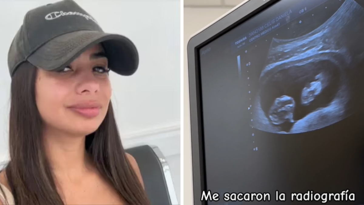 Bomba: Daniela Celis podría tener trillizos en vez de gemelos