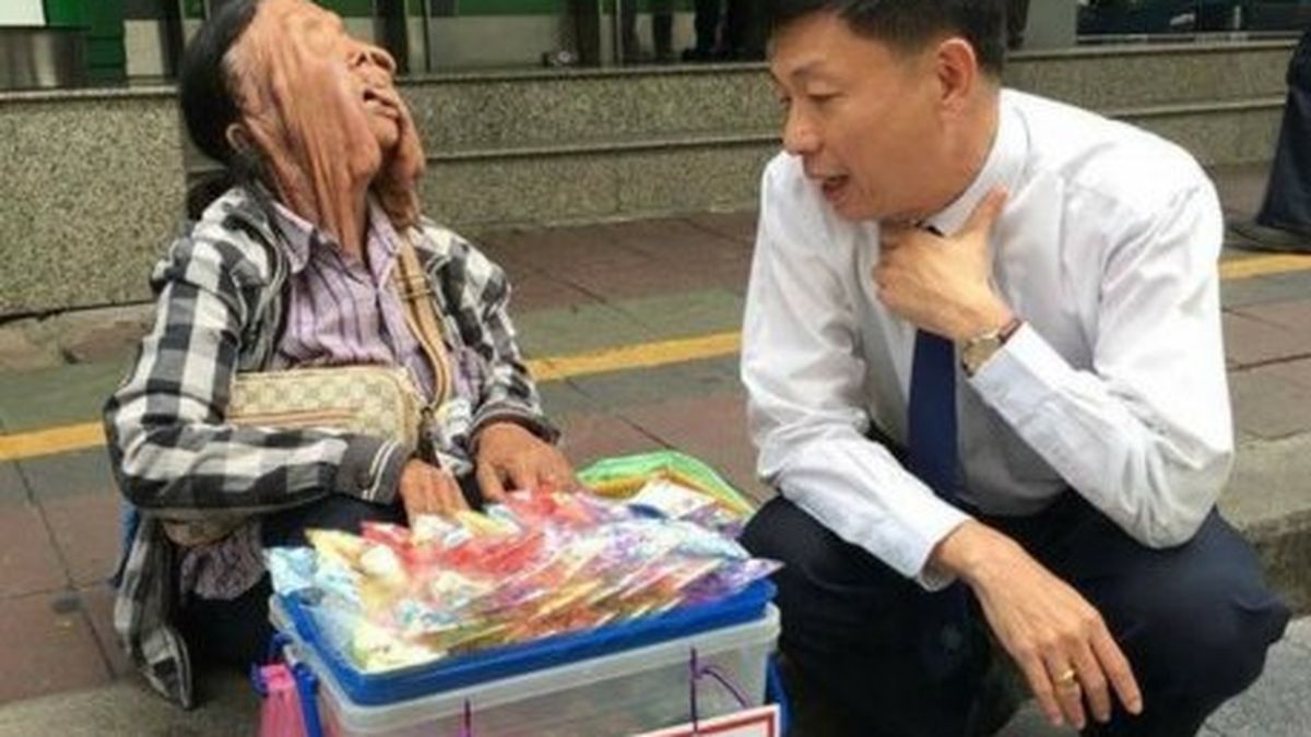 VIDEO: Tiene la cara “derretida” por una extraña enfermedad