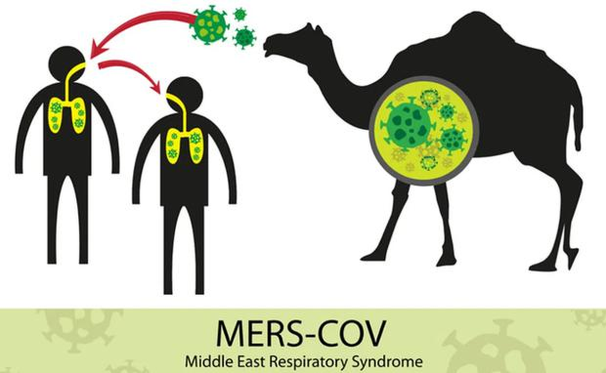 El virus del camello: en qué consiste esta enfermedad que podría ...