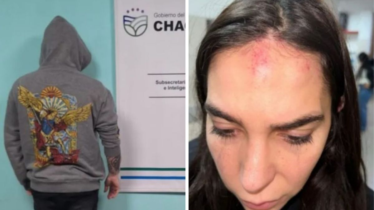 Luciana Milessi y su expareja fueron internados por intoxicación: él ...