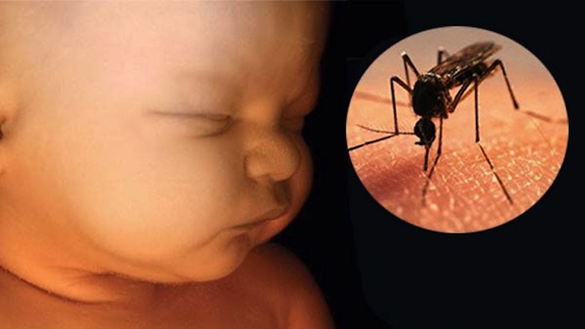 Investigan posible caso de zika tras el nacimiento de un bebé con microcefalia
