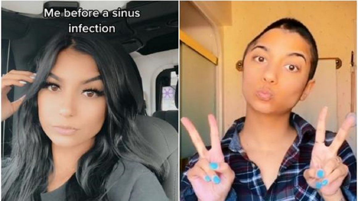 La historia de superación de una joven de 25 años a la que tuvieron que ...