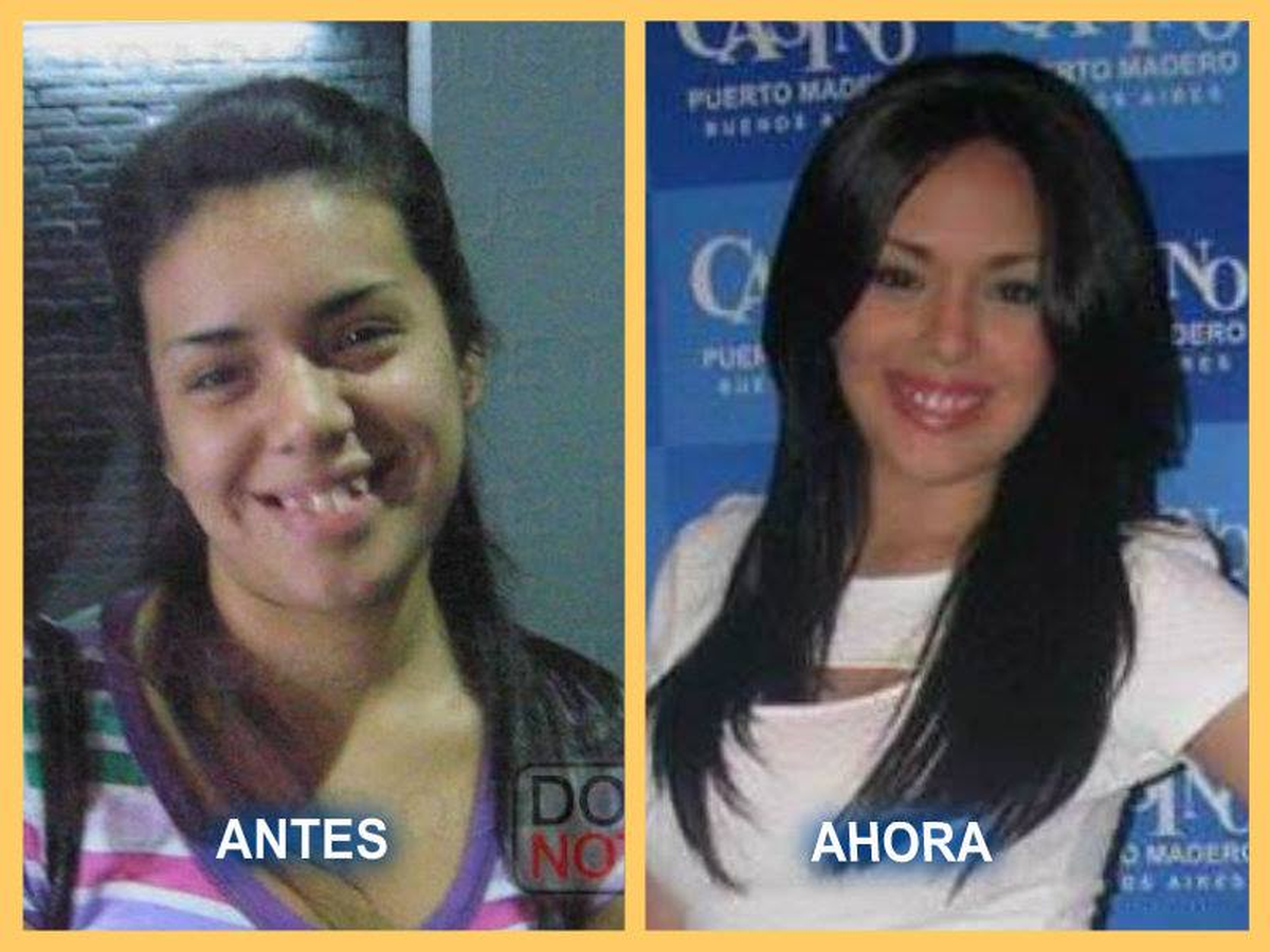 Antes y después de la fama: la SORPRENDENTE transformación de Ángela Leiva