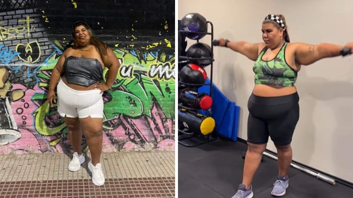 Camilota de Cuestión de peso subió una foto al desnudo desde la clínica de Alberto Cormillot ...