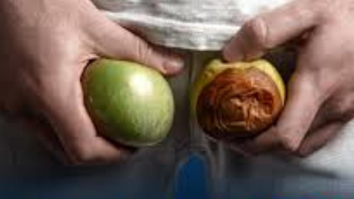 Botox íntimo masculino: qué es, cómo funciona y por qué muchos hombres ...