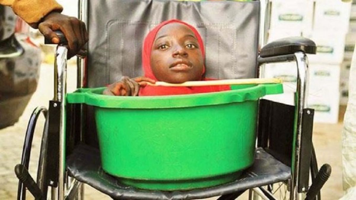 Rahma Haruna la joven sin cuerpo que vivía en un balde