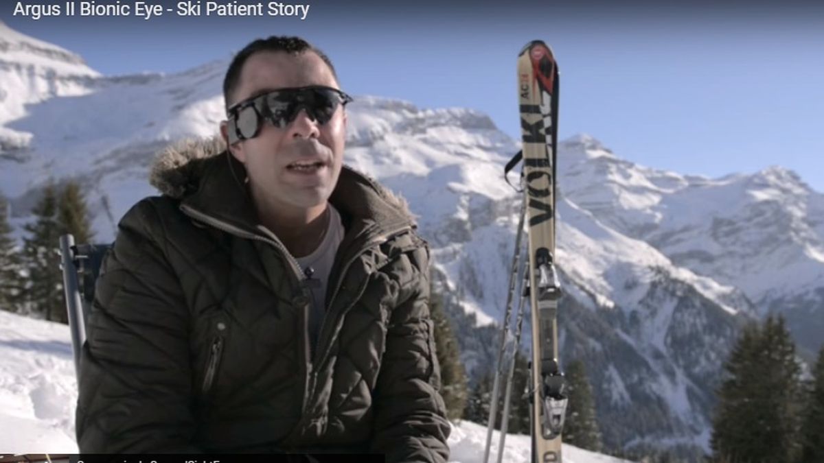 Llega el ojo biónico que devuelve parte de visión en caso de ceguera ...