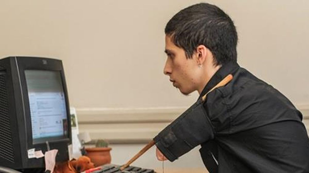 “No, no me dejés así…”: perdió sus brazos en un accidente y contó su ...