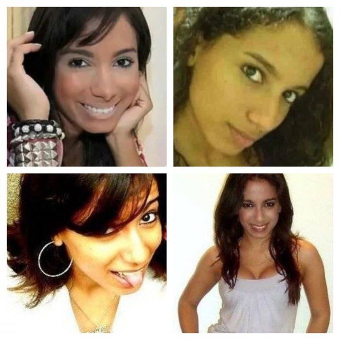 Así era el rostro de la cantante Anitta antes de operarse toda