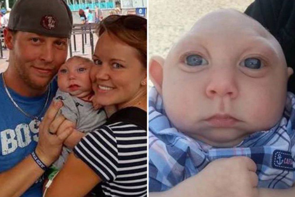 Murió el niño milagro: vivió cinco años sin el 80% de su cerebro