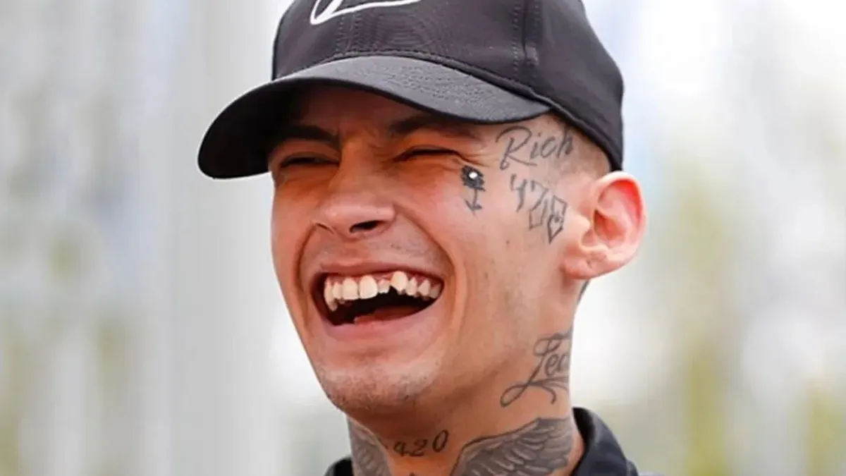 L-Gante se sometió a un tratamiento estético y sorprendió a sus fans