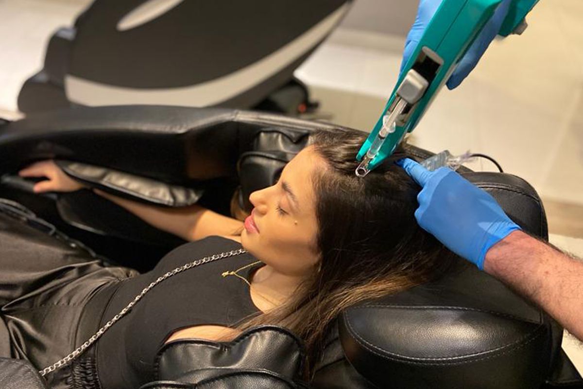 Se triplican las consultas capilares en Hair Recovery Santa Fe