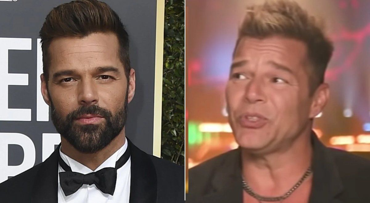 Ricky Martin reapareció con la cara operada y las redes estallaron de memes