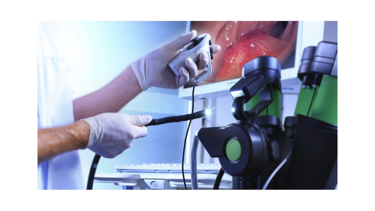 ¿Para qué sirve una endoscopía y qué riesgos tiene?