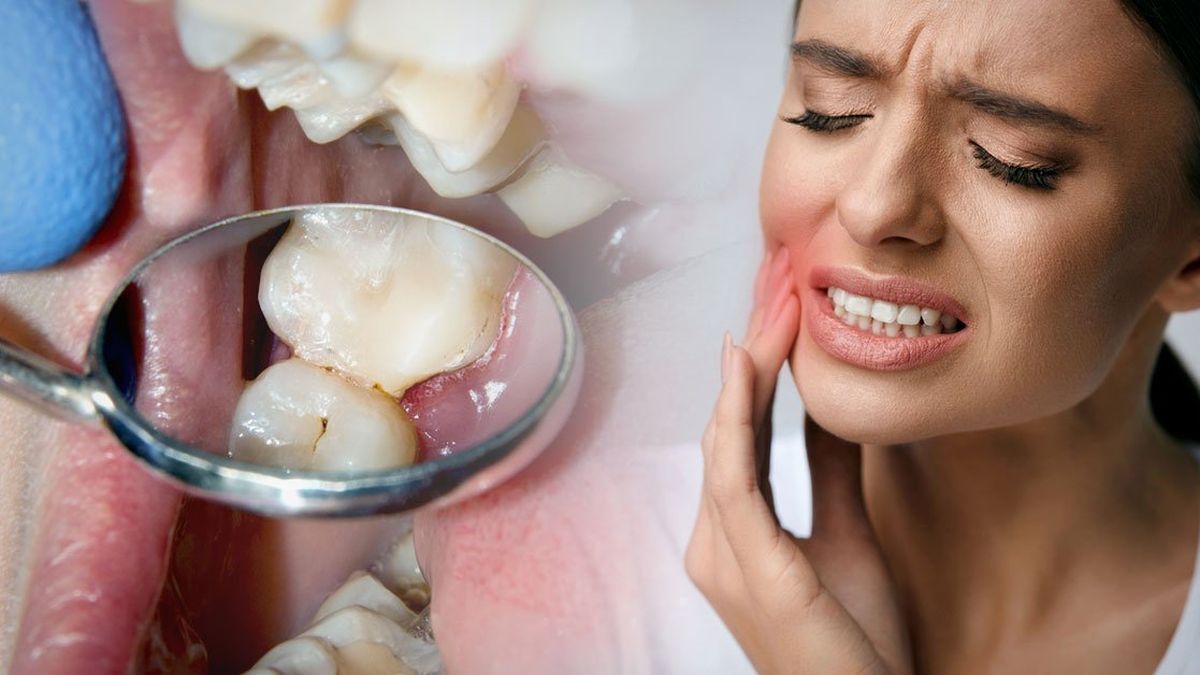 Estas pueden ser las causas de las caries en adultos