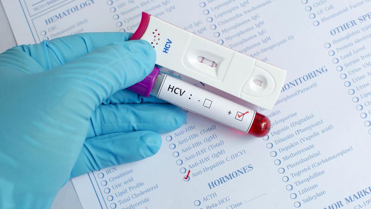 Hepatitis C: la importancia de un simple análisis para detectar esta ...